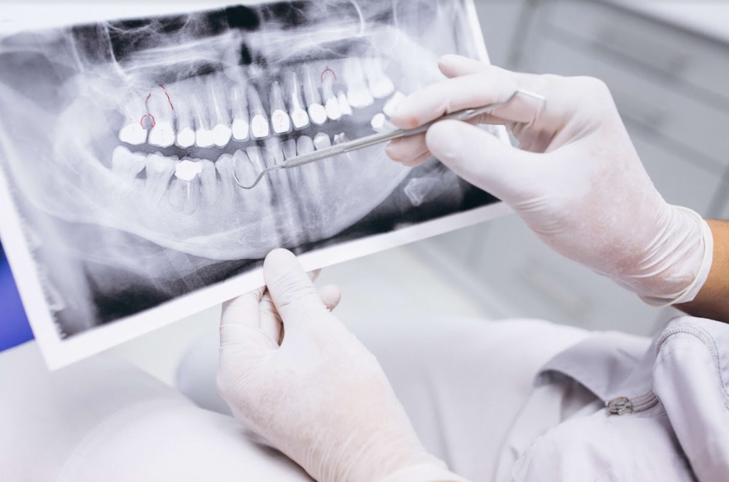 Panoráma röntgen: mire használható a fogászatban? - Dr. Németh Bálint